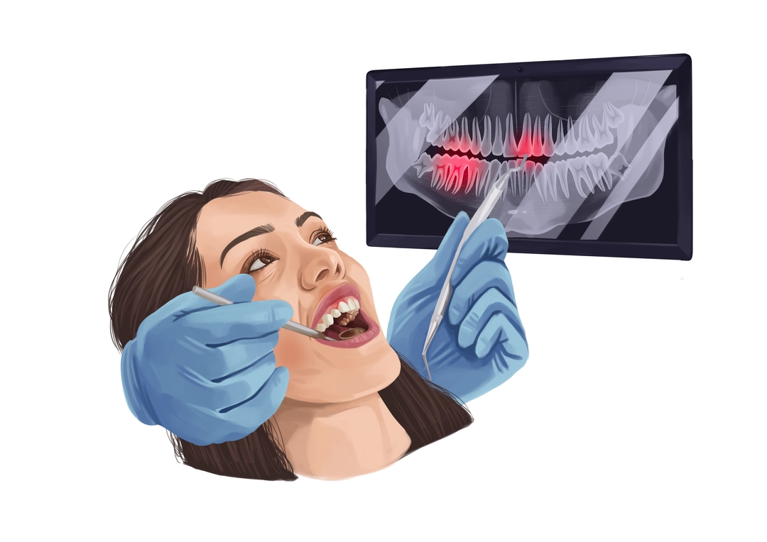 What is a dental exam? How much does it cost? | Authority Dental