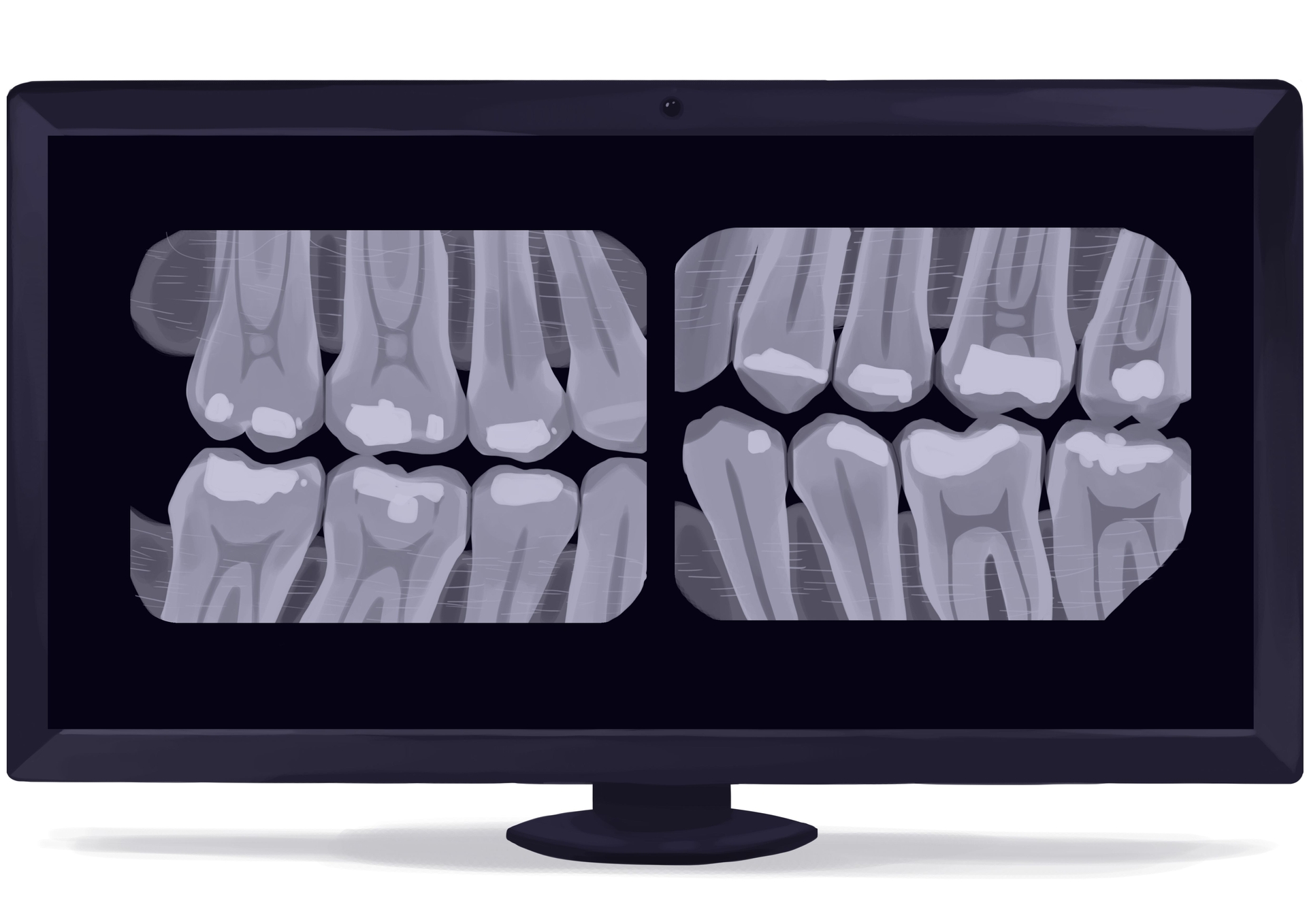 How often should you get dental x-rays? How much does it cost ...