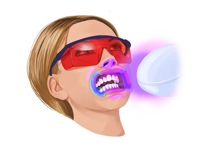 Cheap Dentist in Oakland, CA | No Insurance, Same-Day Care