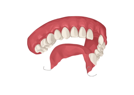 How to replace a missing tooth? | Authority Dental