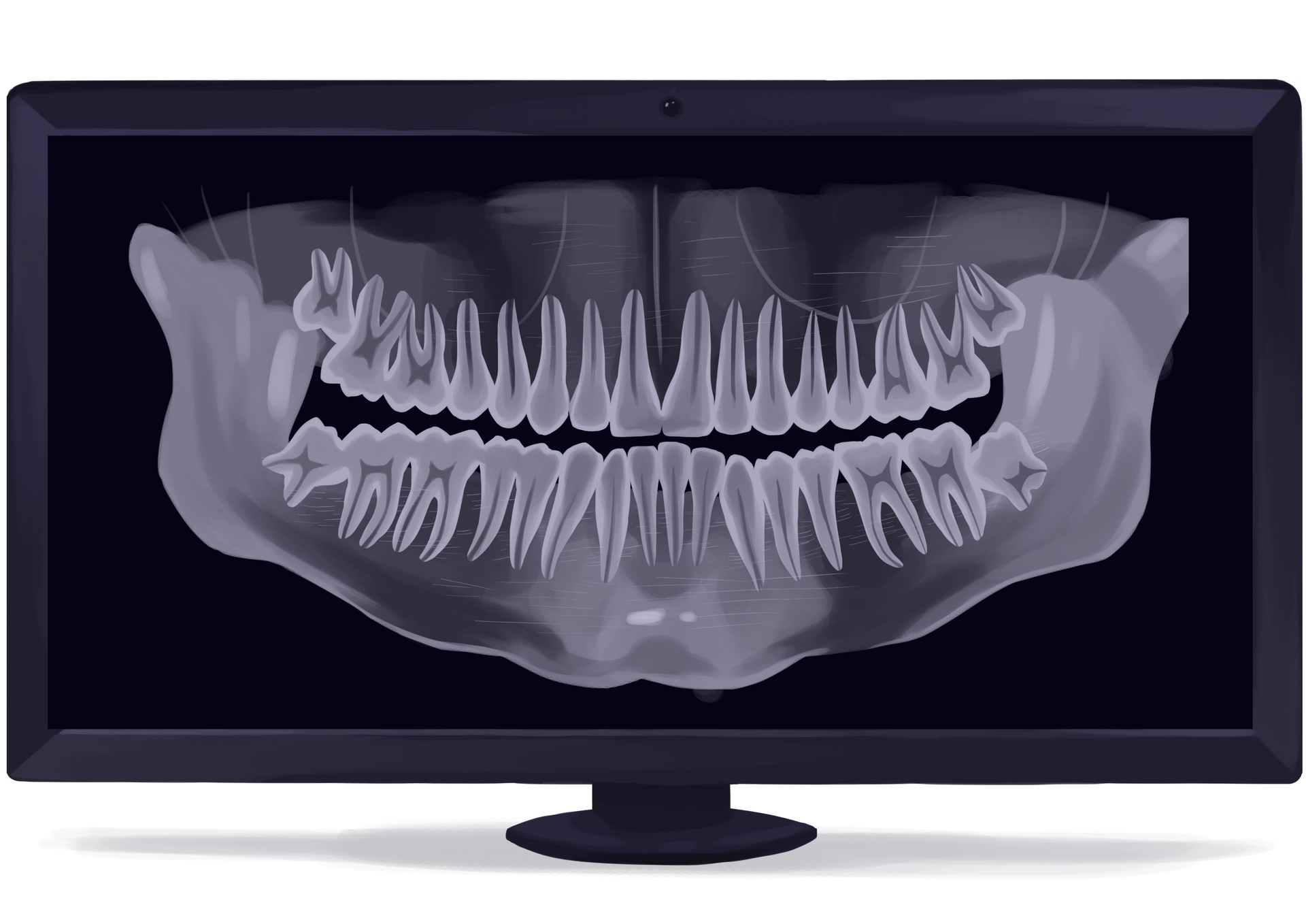 How often should you get dental x-rays? How much does it cost ...