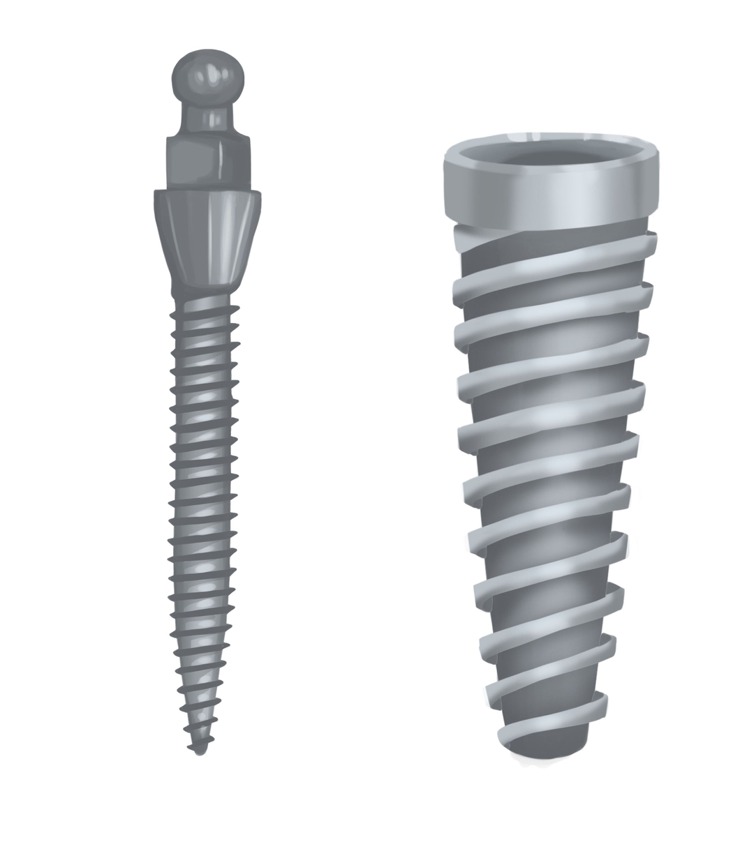 What are mini dental implants? | Authority Dental