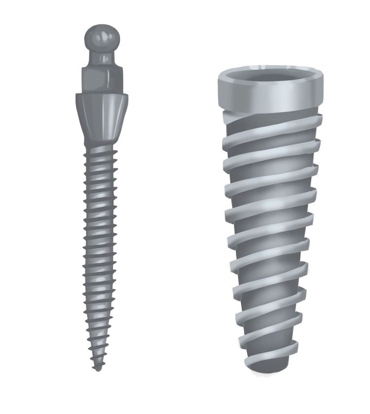 What are mini dental implants? | Authority Dental