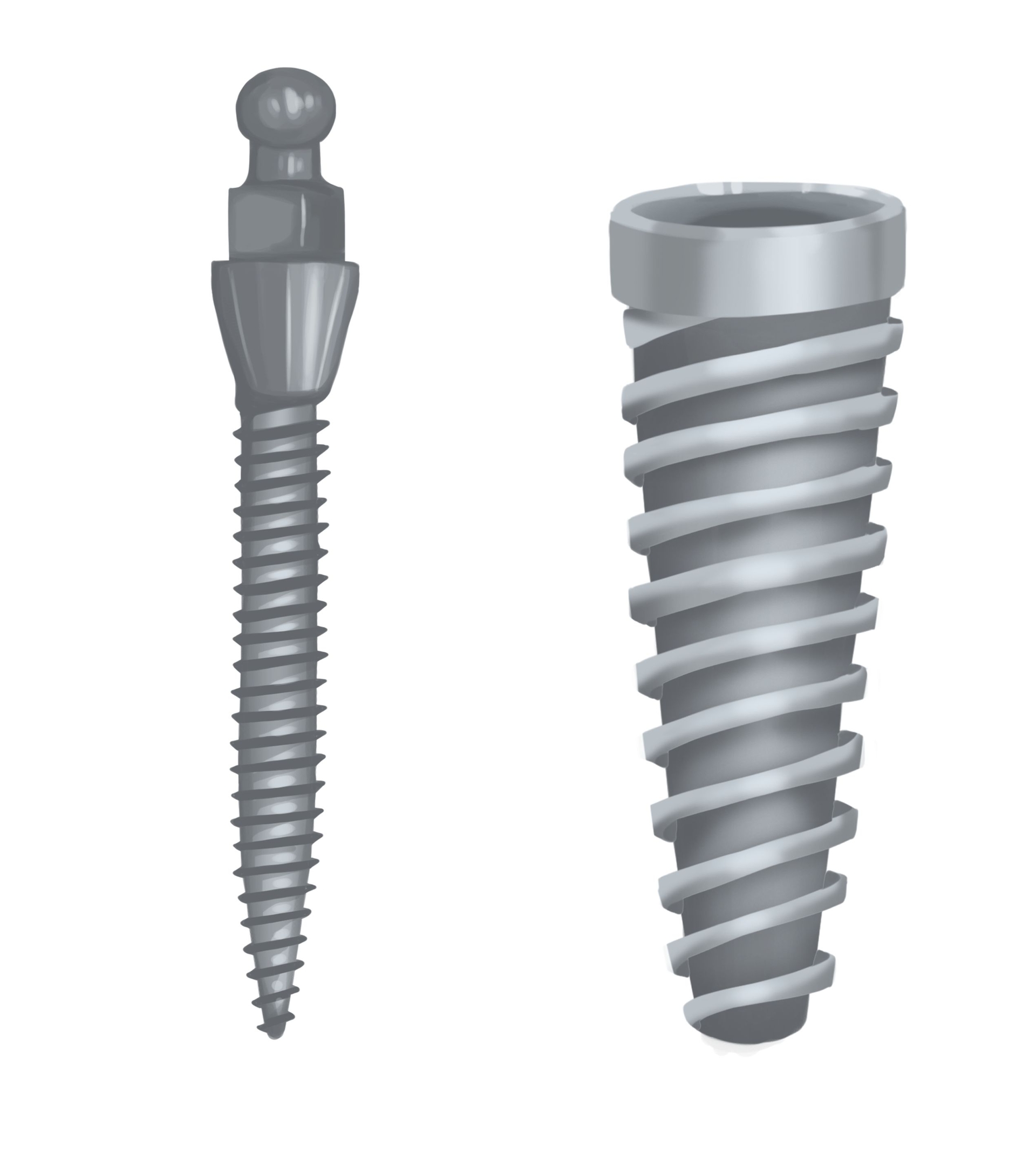 What are mini dental implants? | Authority Dental