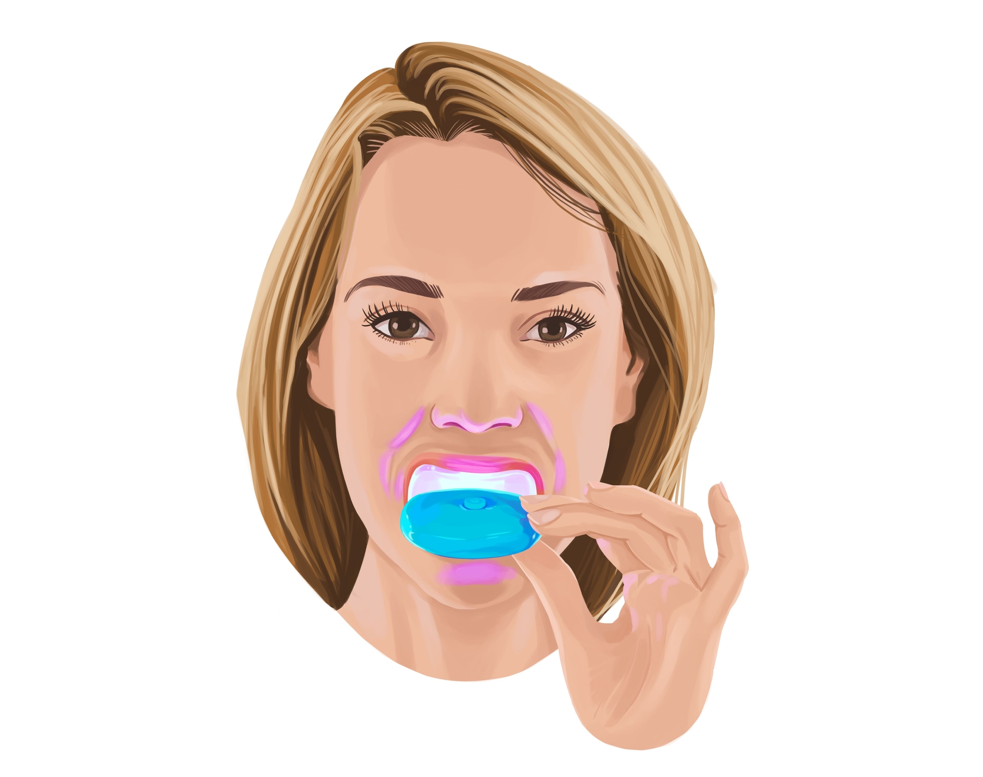 How to whiten dentures? | Authority Dental