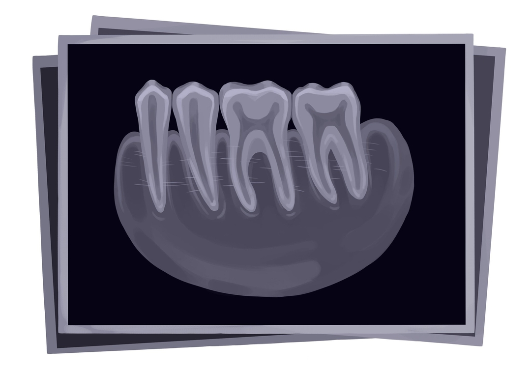 walk-in-emergency-dentist-in-naples-fl-walk-in-dentist-near-me