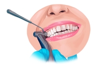 Professional Teeth Cleaning: What It Is & Why It Matters | Authority Dental