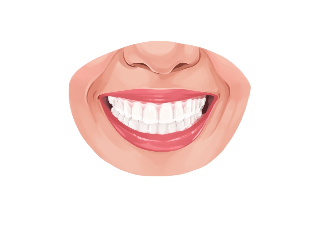 Invisalign Cost & Price Guide | With and Without Insurance | Authority ...