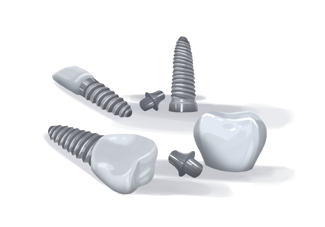 Cheap Dentist in Moreno Valley, CA | No Insurance, Same-Day Care