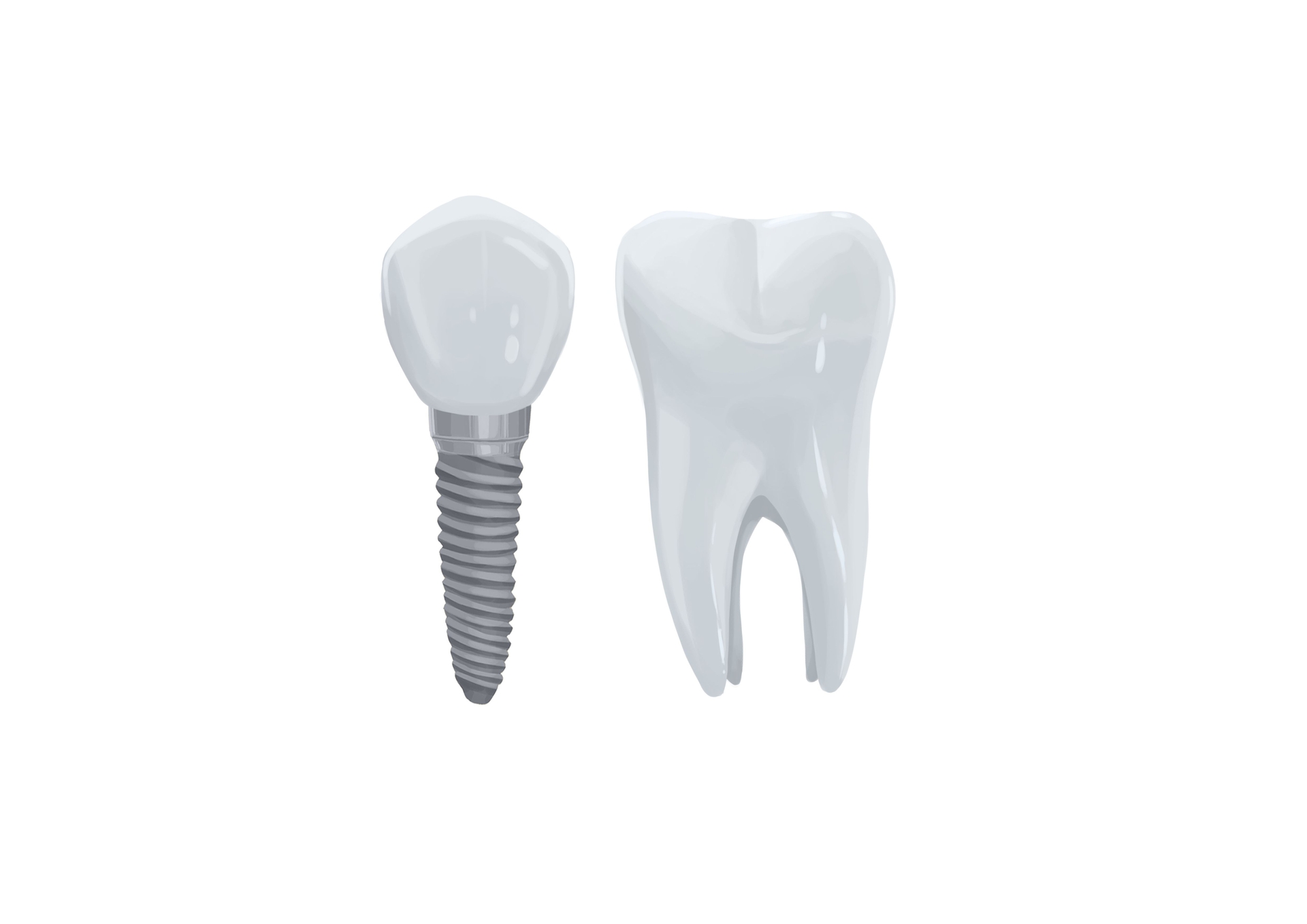Does Medicaid pay for dental implants? | Authority Dental
