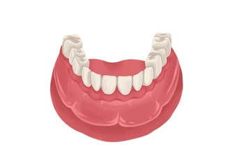 What are the most common lower dentures problems? | Authority Dental