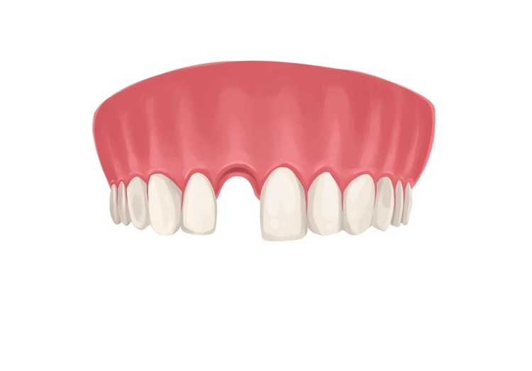 WALK-IN EMERGENCY DENTIST in Louisville, KY | Walk-in dentist near me ...