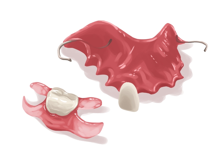 Flipper Tooth: Cost, Pros & Cons, and Who It’s Best For | Authority Dental